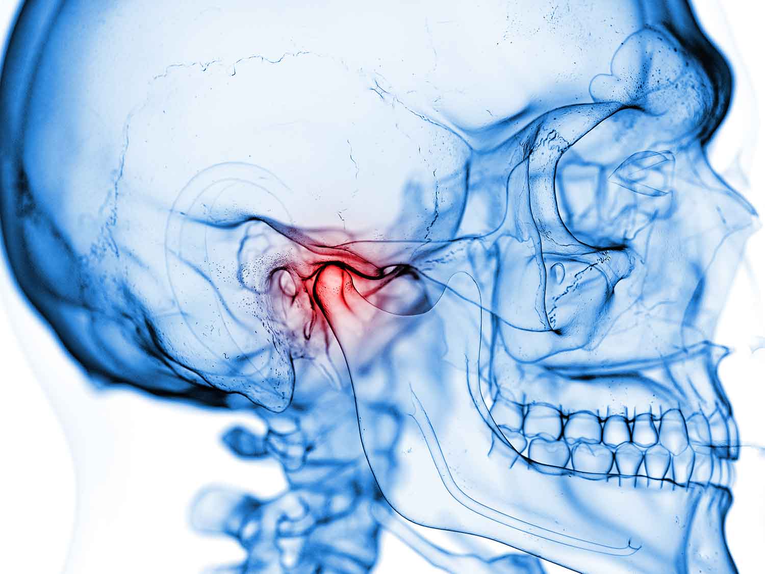 TMJ Treatment in Ridgeland, MS | Expert Solutions for Temporomandibular ...